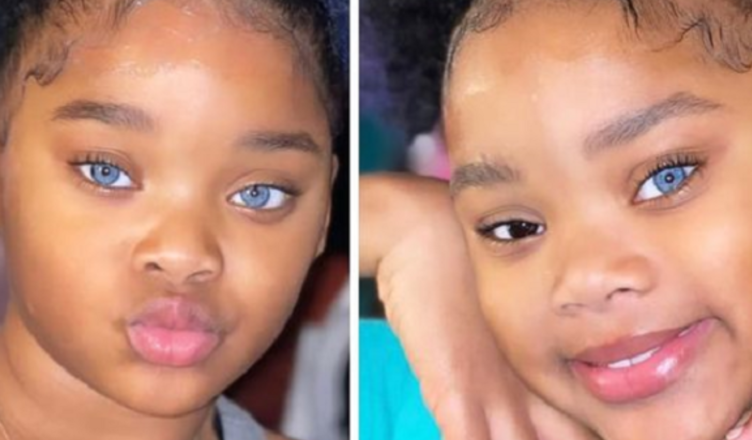 The "Blue Twins" gained fame because of their eyes, and this is how ...