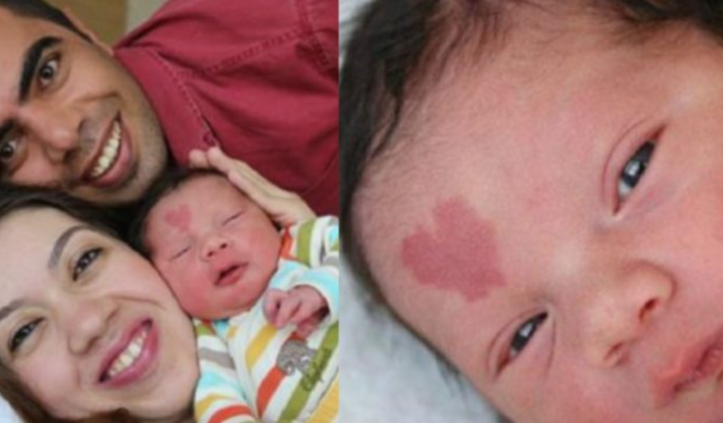 This baby was born with a unique birthmark and here is how he looks ...