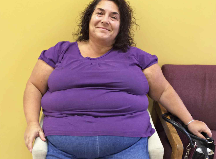 This Woman Lost Over 300 Pounds and Looks Totally Unrecognizable After ...